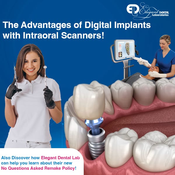The Advantages of Digital Implants with Intraoral Scanners | Elegant Lab